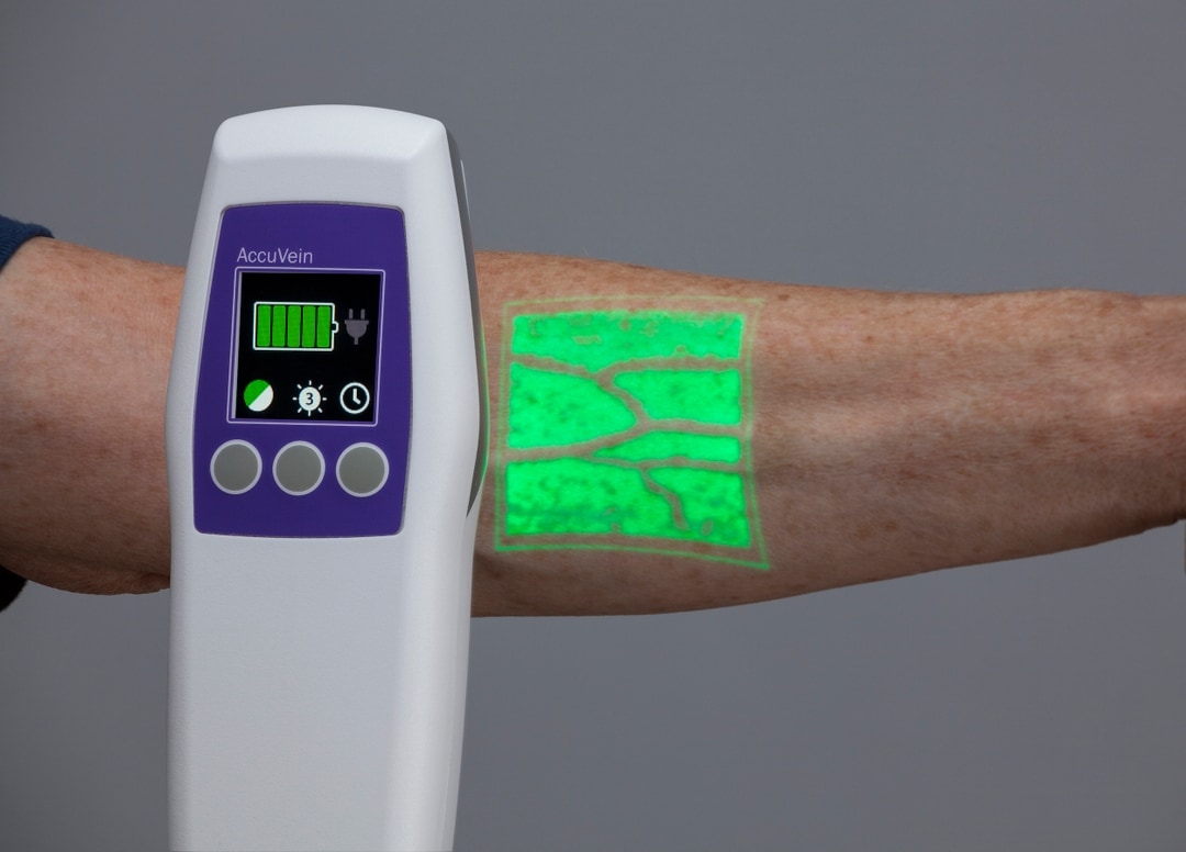 AccuVein: The New AccuVein AV500