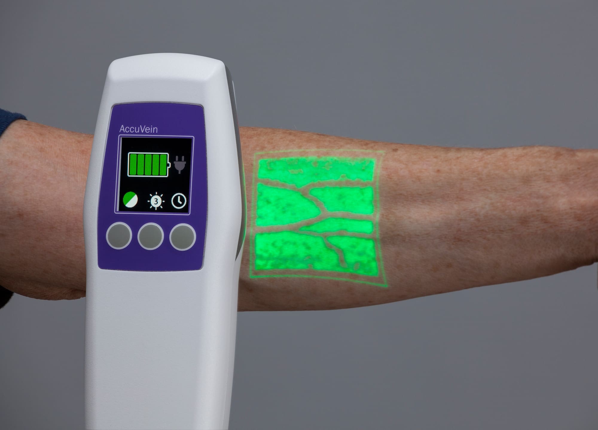 AccuVein: The New AccuVein AV500